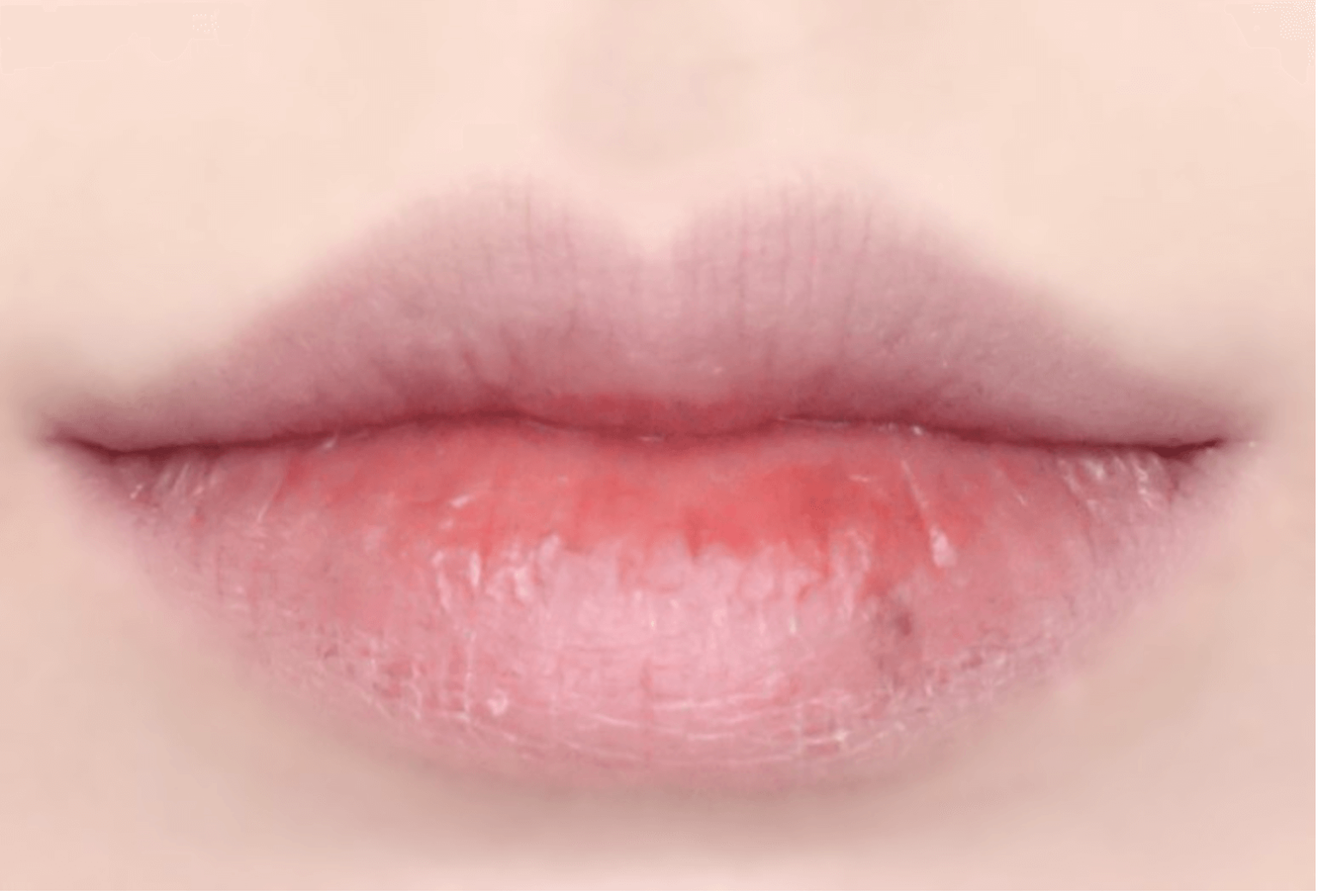 Como Hidratar Labios Secos y Partidos